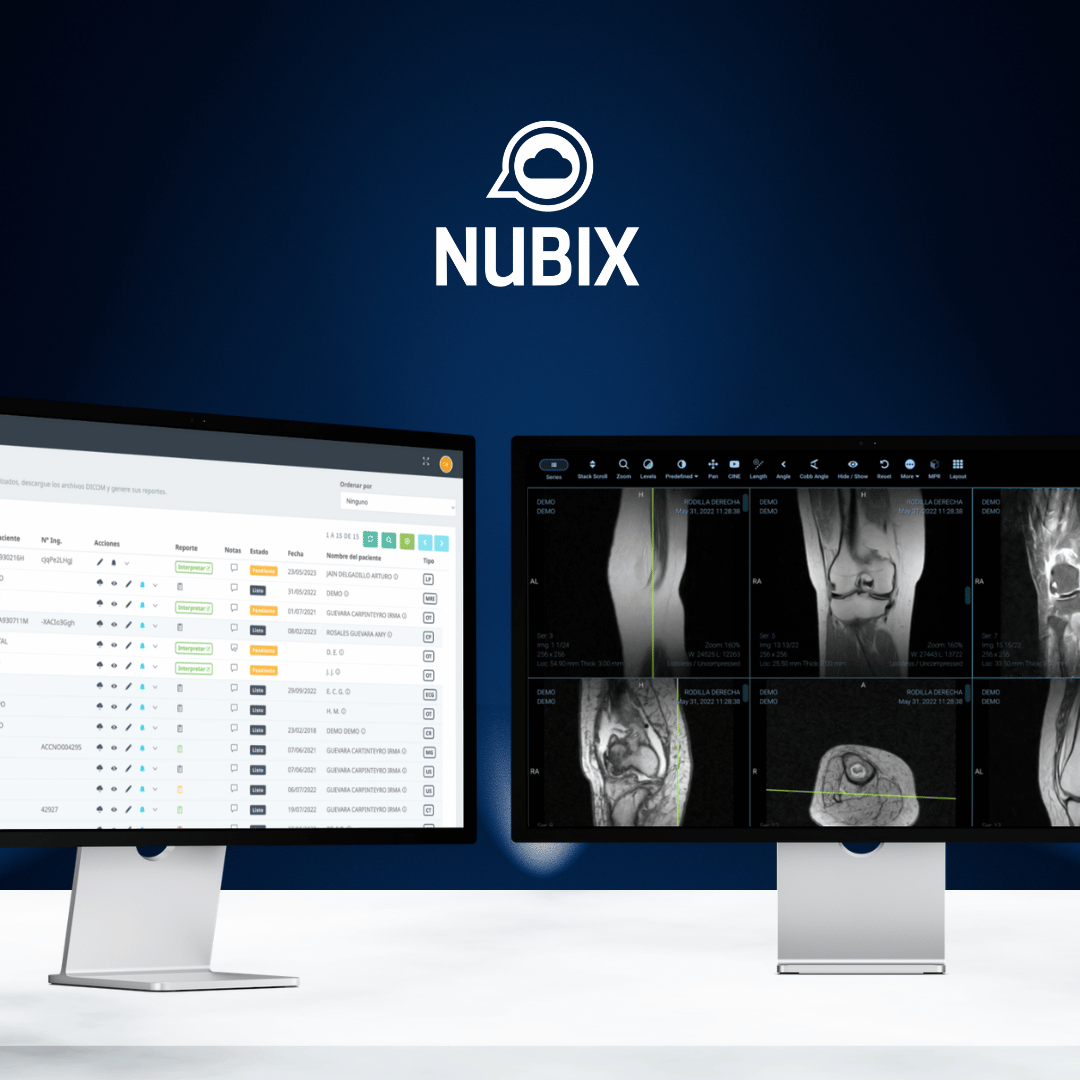 Registrate y ve una demostración - NUBIX