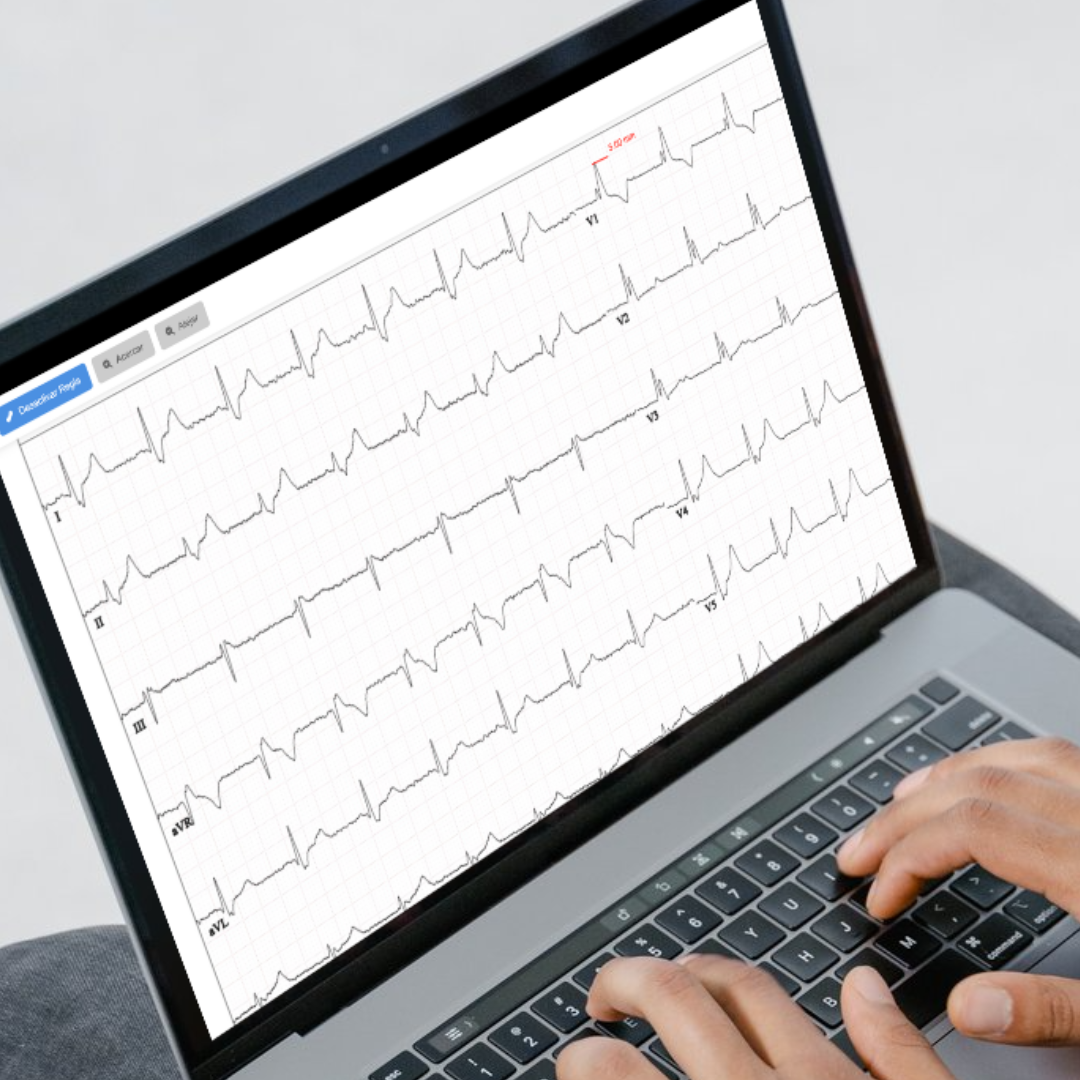 Cardiología en la nube - NUBIX